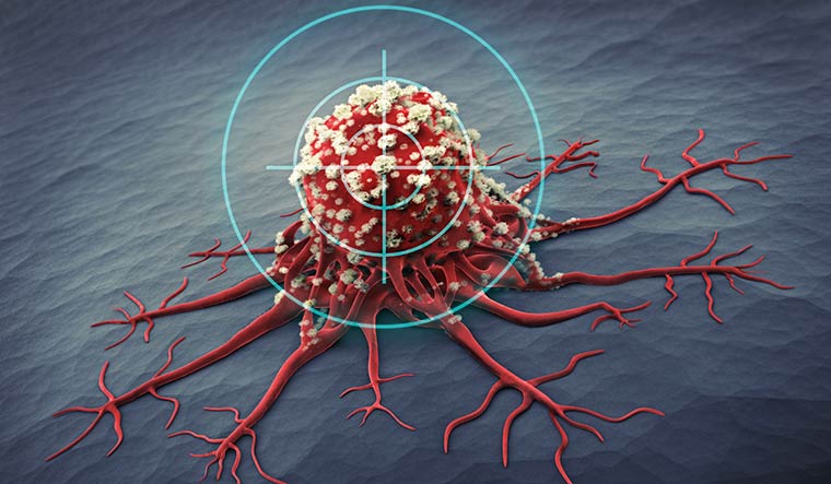 Brachytherapy provides focused and shorter treatment options to cancer ...