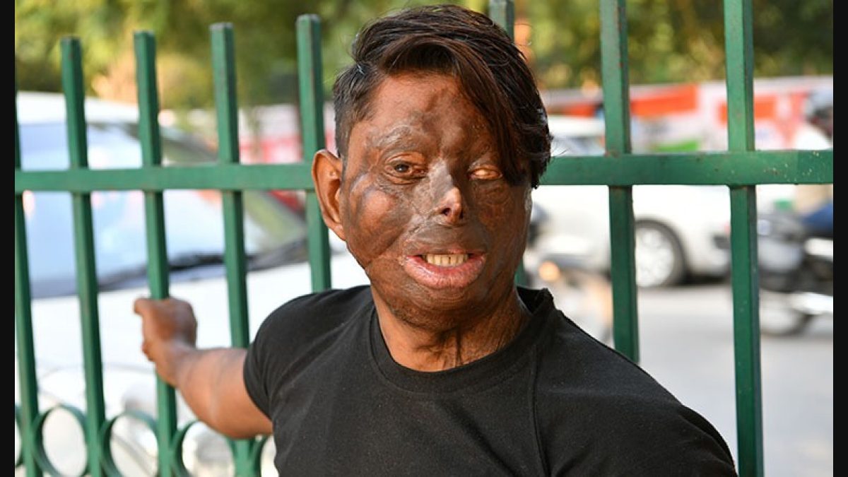 Acid Attack Victims Before And After
