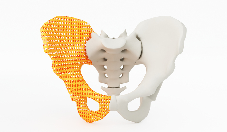 3D bioprinting of tissues will help hasten bone fracture healing- The Week