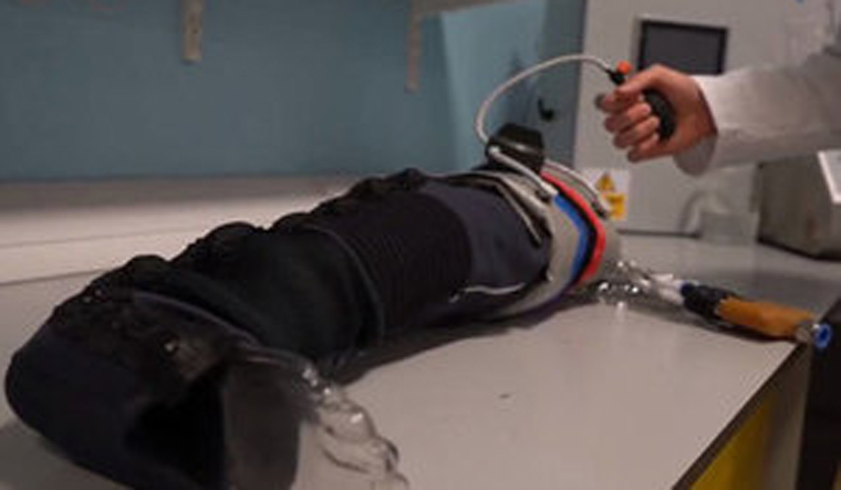 British scientists develop new kit to save soldiers' limbs after IED ...