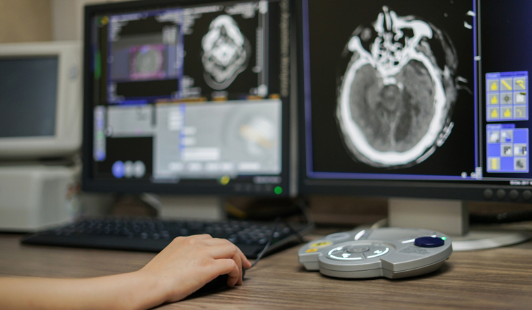 Researchers ‘hack’ CT scans to create fake cancers in imaging - The Week