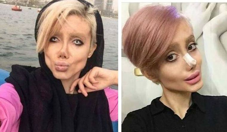 Instagram star, popular for frequent plastic surgeries, arrested for ...