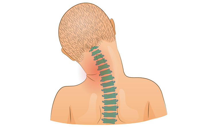 Spot a tilt in your baby's neck?- The Week