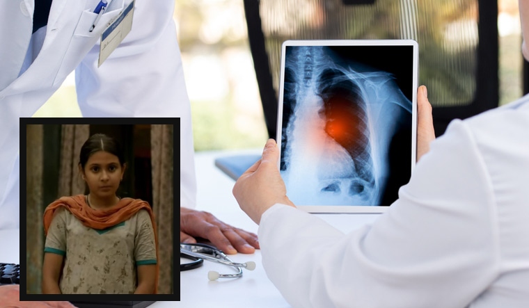 What is Dermatomyositis - the rare autoimmune disease that claimed 'Dangal' actor Suhani ...