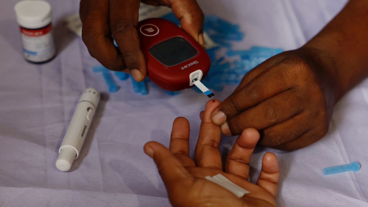 Stem cell therapy offers hope for type 1 diabetes patients- The Week