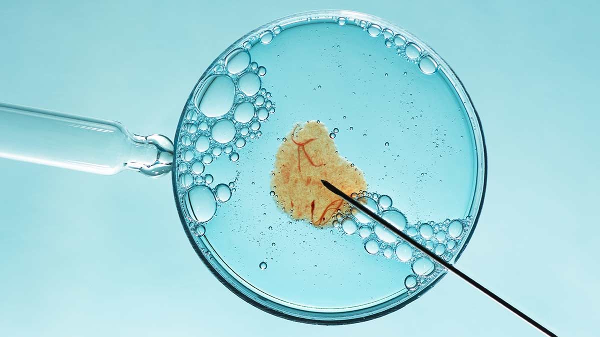 Fresh embryo transfer boosts IVF success- The Week