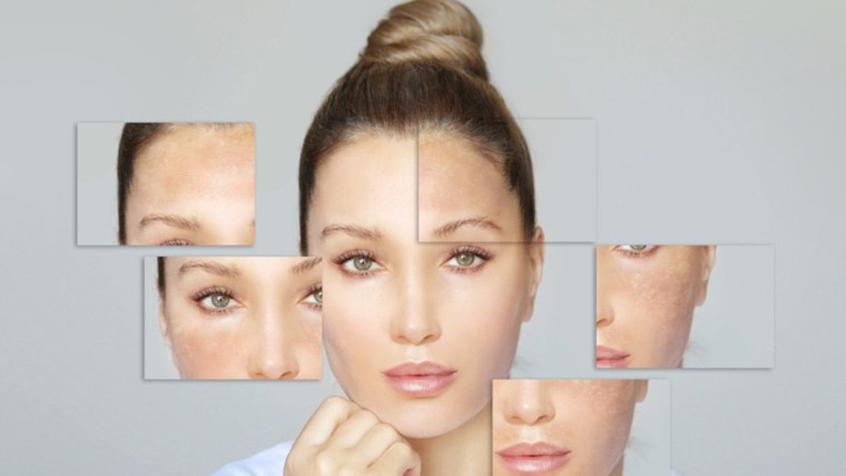 Melasma explained: Causes, triggers, and treatment options for facial ...