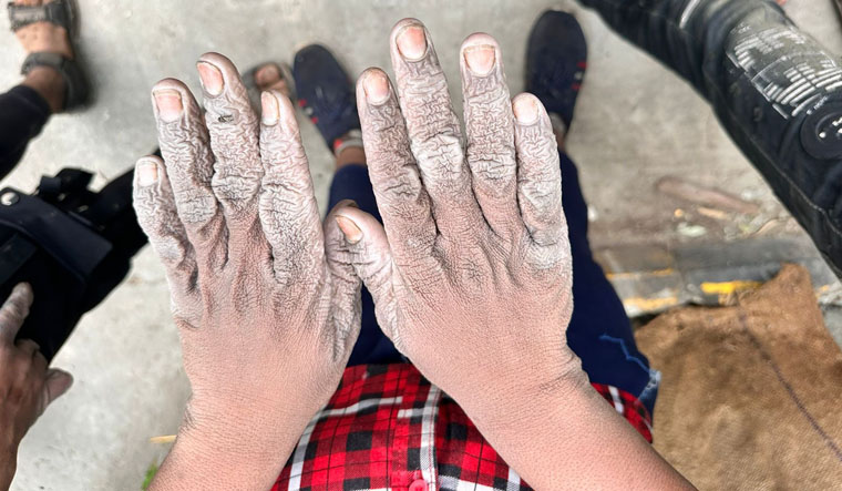 39 child labourers rescued by NCPCR from MP distillery ‘disappear ...