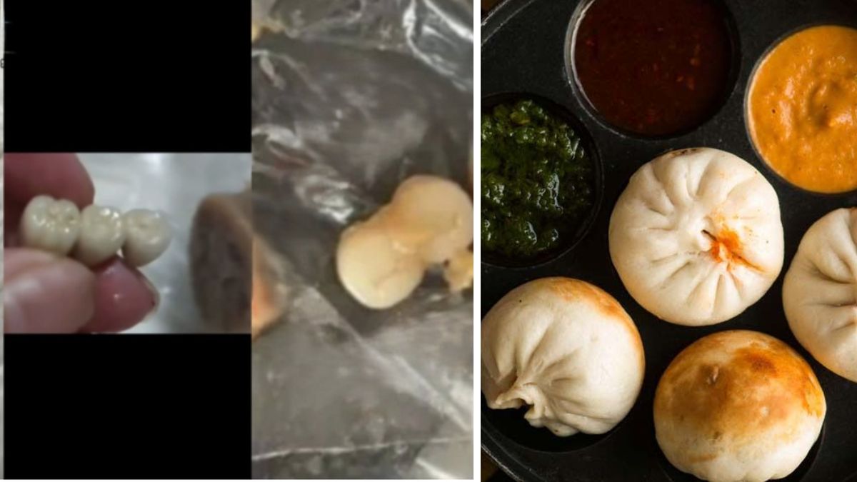 ‘Human teeth’ found in dim sum, sausages in China, sparks outrage over ...