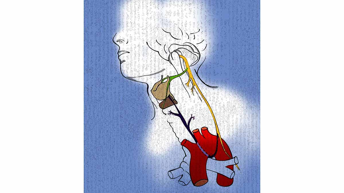 Epilepsy treatment: Exploring vagus nerve stimulation- The Week